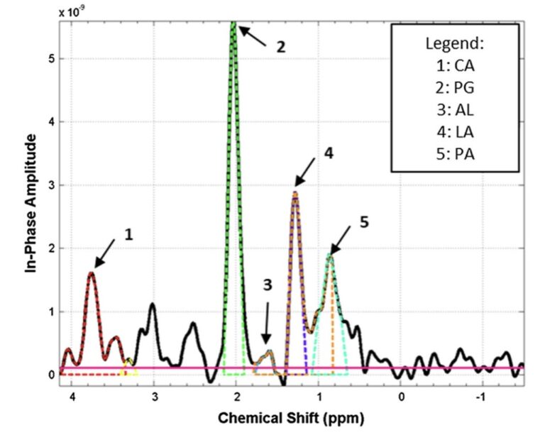 MRI DISC SPECTROSCOPY vs INVASIVE DISCOGRAPHY FOR IDENTIFYING PAINFUL ...