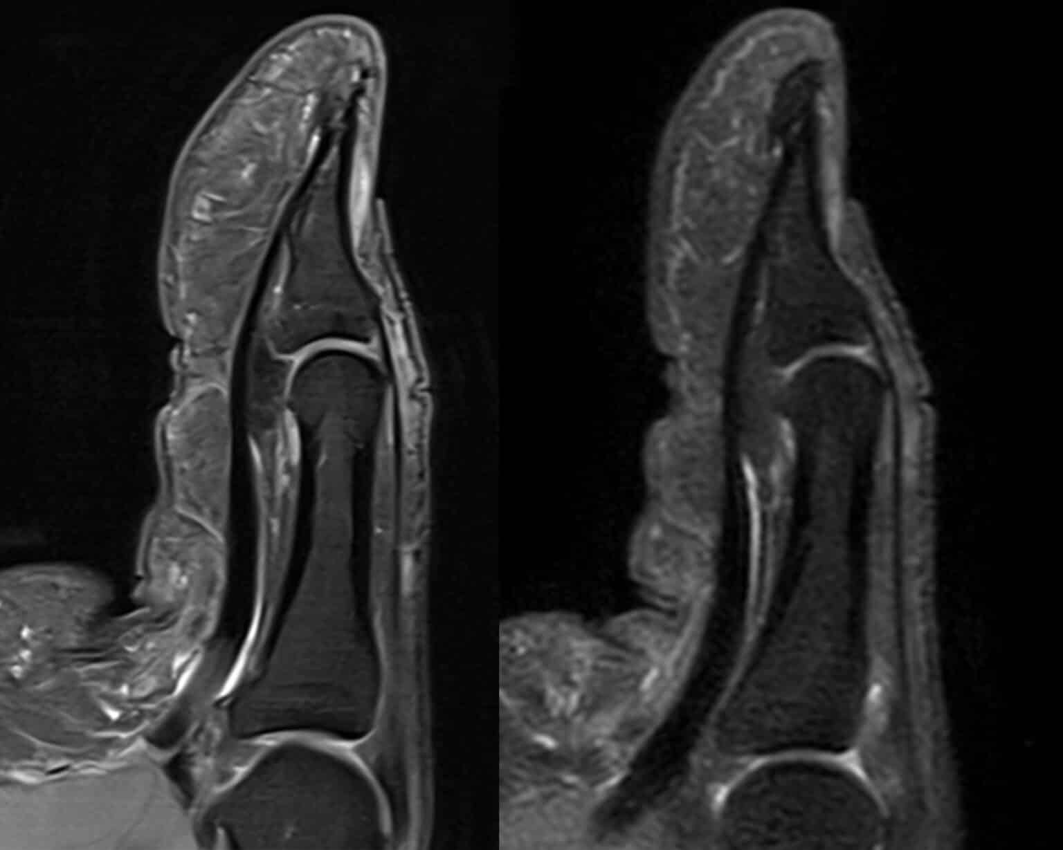 MRI Scan Gold Coast - Panorama Radiology Specialists